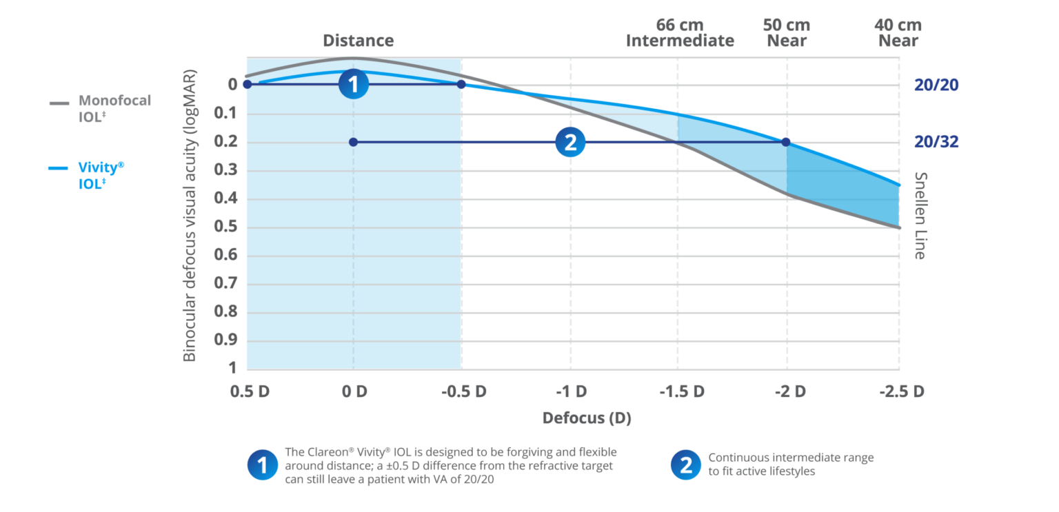 クラレオンビビティ（Clareon Vivity）の使用感について｜荻窪駅前眼科｜白内障手術、網膜硝子体手術、緑内障手術